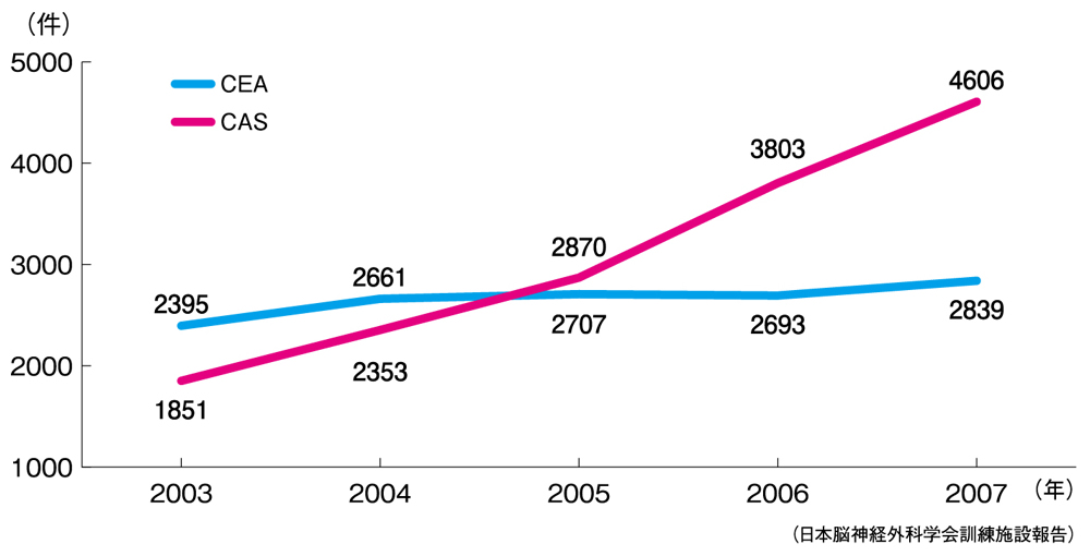 頚動脈内膜剥離術（CEA）―これから術者になる先生方へ― | ミクス+ | ミクスOnline